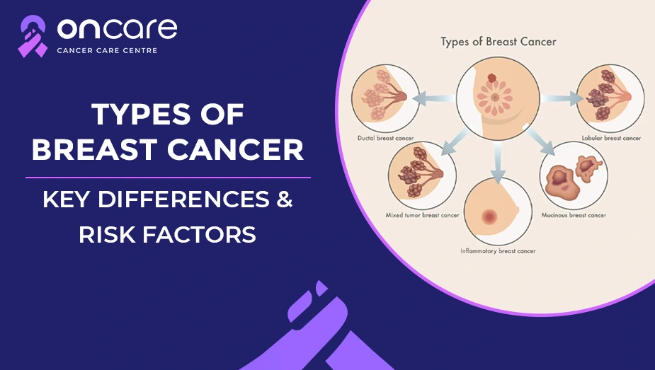 Types Of Breast Cancer Key Differences Risk Factors And Treatment Options